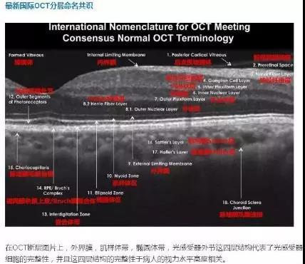 眼科新手必读：OCT结果解读 - 好大夫在线