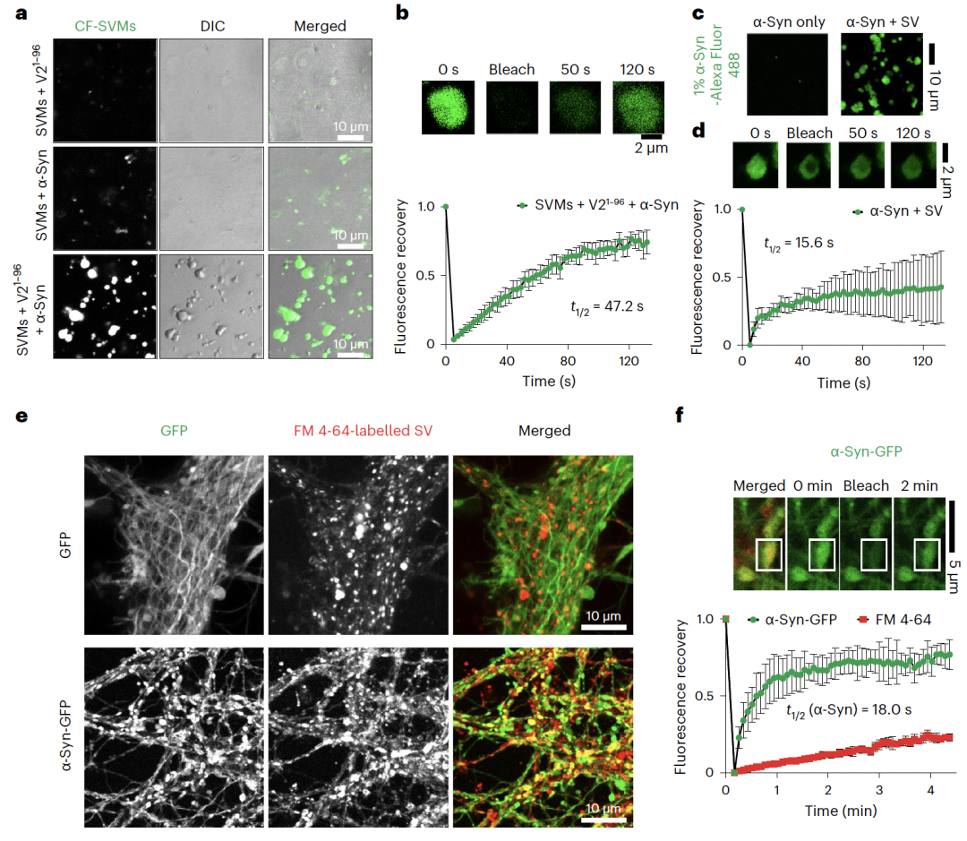 Nat Cell Biol | 李丹等发现帕金森病致病蛋白α-Syn相分离的生理功能及调控机制 - 好大夫在线