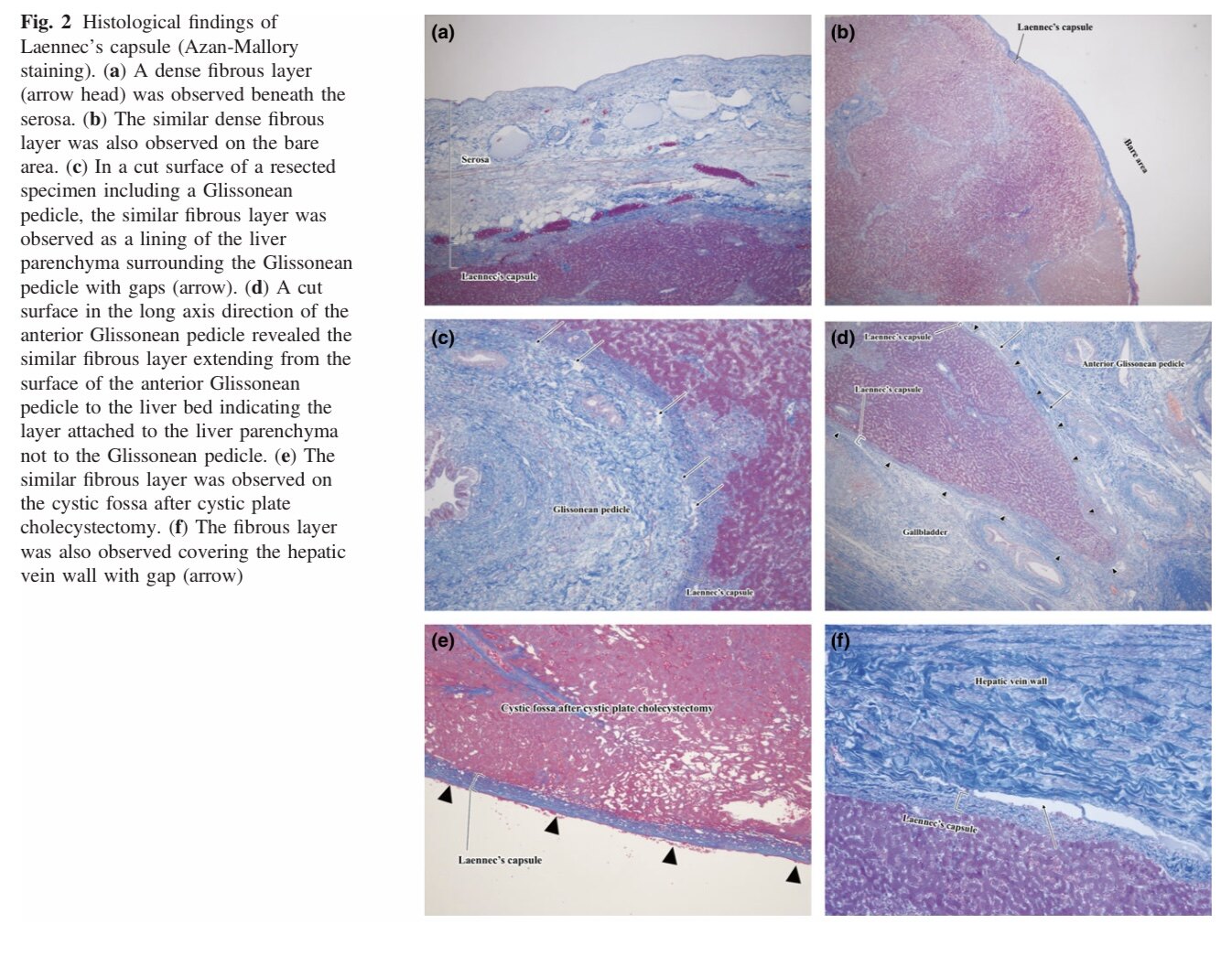 肝胆外科的历史巨擎们-站在巨人的肩膀上：Francis Glisson和“六扇门” - 好大夫在线