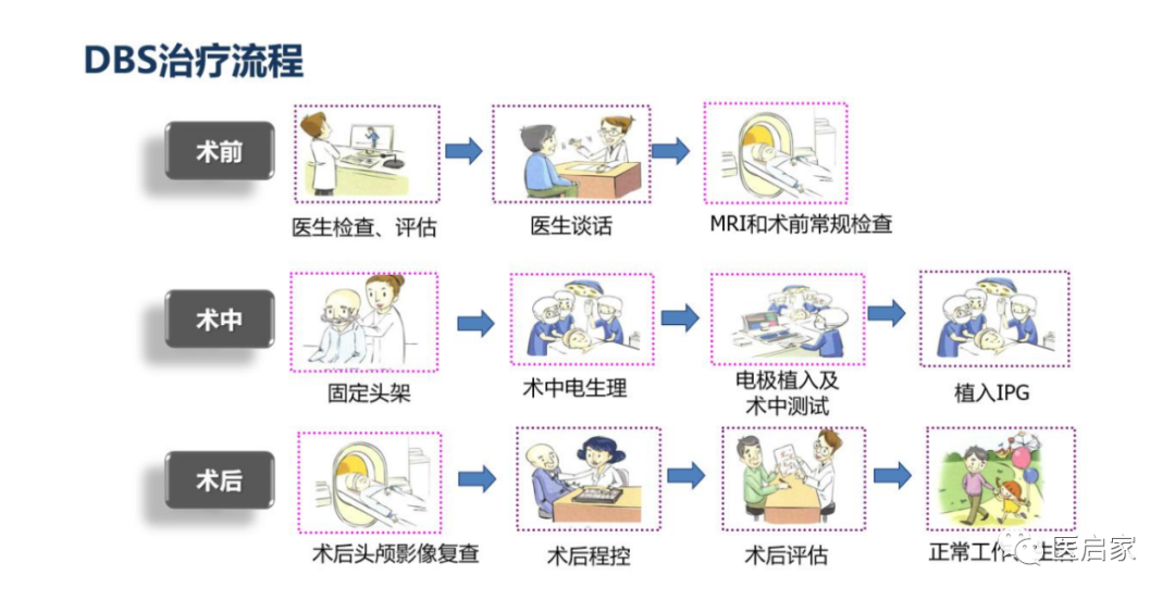 Alipay